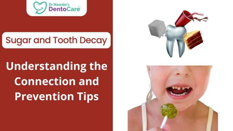 Sugar and Tooth Decay: Understanding the Link and How to Prevent Cavities