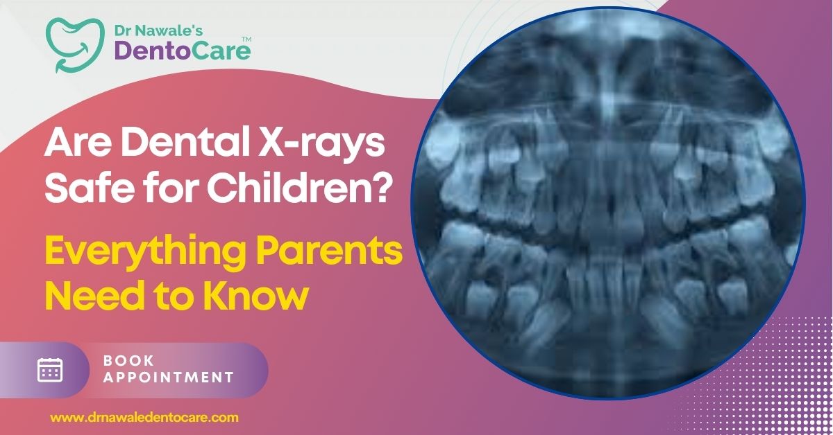 Are Dental X-rays Safe for Children? Parents Need to Know