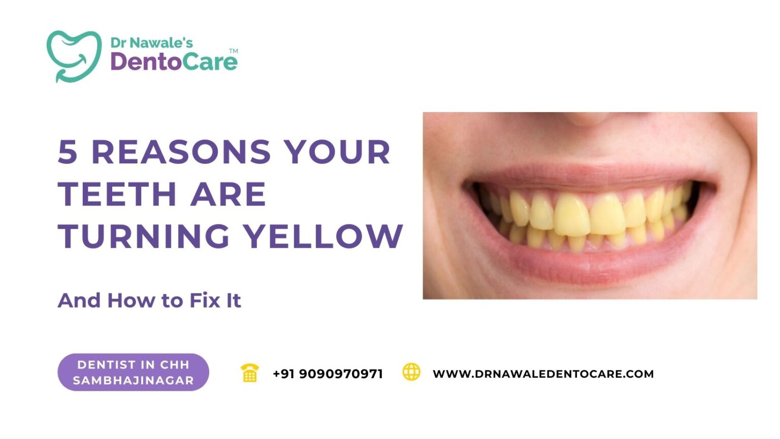 5 Reasons Your Teeth Are Turning Yellow (And How to Fix It)